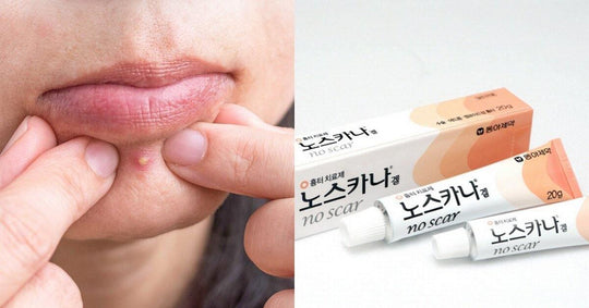 DONG-A PHARM Noscarna Acne Scars Removal Gel Large Size 20g – LMCHING ...